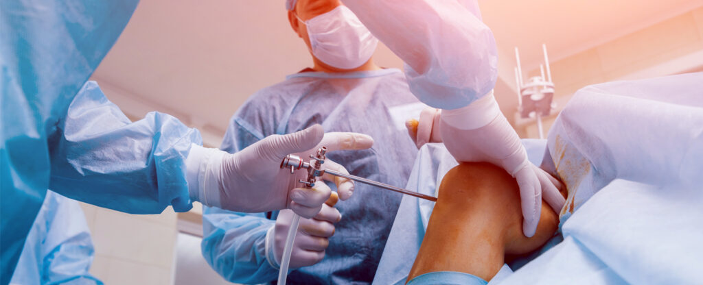 Keyhole Surgeries / Arthroscopy – hyderabadorthospine